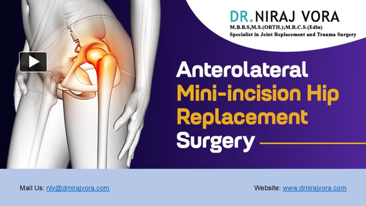 PPT – Anterolateral Mini-incision Hip Replacement Surgery | Dr Niraj ...