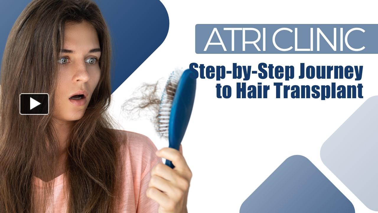 PPT – Step-by-Step Journey to Hair Transplant PowerPoint presentation ...