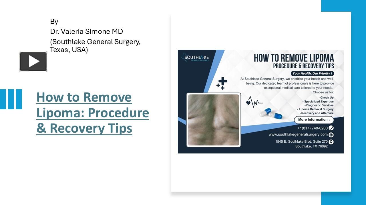 How to Remove Lipoma: Procedure & Recovery Tips presentation | free to ...