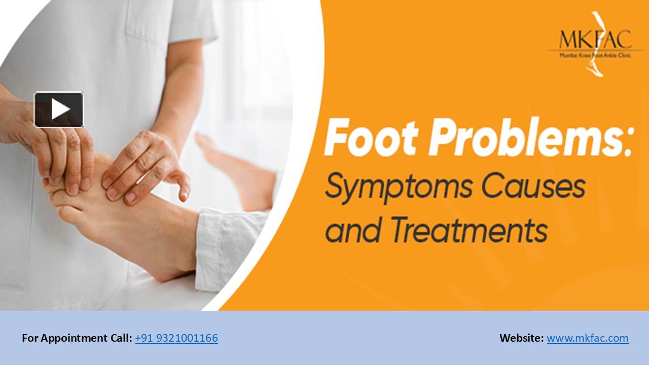 PPT – Feet (Foot) Problems: Symptoms, Causes and Treatments | MKFAC ...