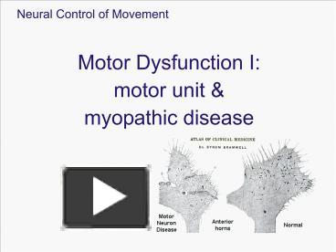 Motor dysfunction: motor unit presentation | free to view