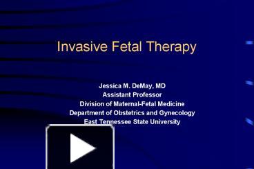 Invasive Fetal Therapy presentation | free to view