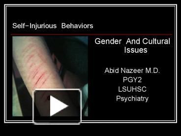 SelfInjurious Behaviors presentation | free to view