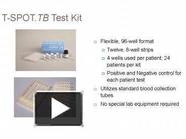 TSPOT.TB Test Kit presentation | free to view