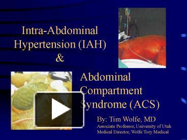 IntraAbdominal Hypertension IAH presentation | free to view