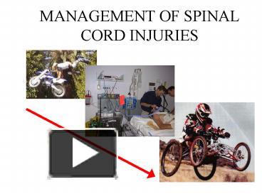 MANAGEMENT OF SPINAL CORD INJURIES presentation | free to view