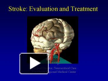 PPT – Stroke: Evaluation and Treatment PowerPoint presentation | free ...