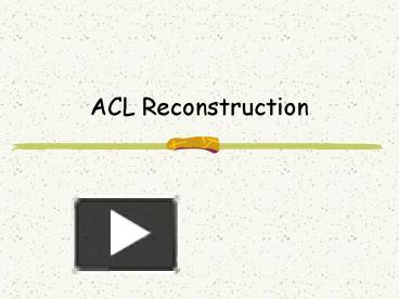 ACL Reconstruction presentation | free to view