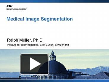 Medical Image Segmentation presentation | free to view
