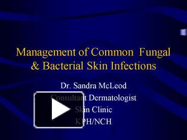 PPT – Management of Common Fungal PowerPoint presentation | free to ...