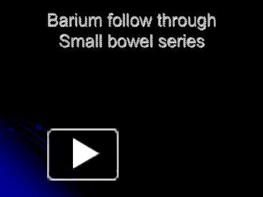 Barium follow through Small bowel series presentation | free to view