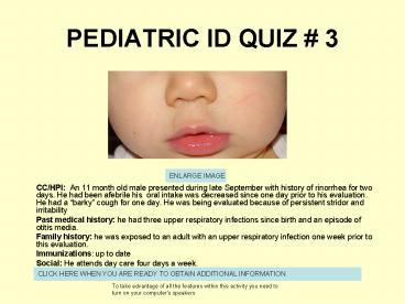 PPT – PEDIATRIC ID QUIZ PowerPoint presentation | free to view - id ...