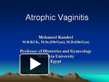 Atrophic Vaginitis presentation | free to view