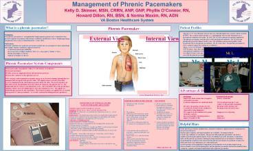 PPT – 36x60 poster template PowerPoint presentation | free to view - id ...