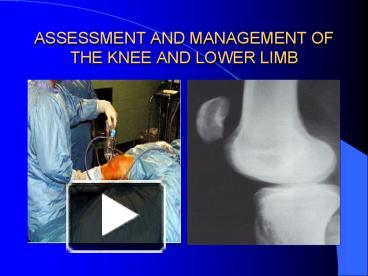 ASSESSMENT AND MANAGEMENT OF THE KNEE AND LOWER LIMB presentation ...