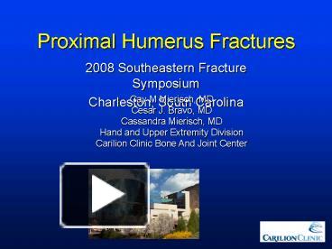 Proximal Humerus Fractures presentation | free to view