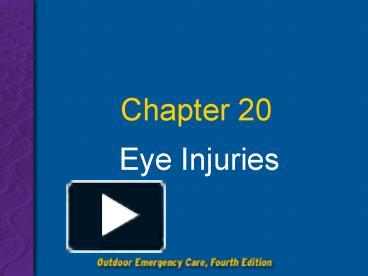Eye Injuries presentation | free to view