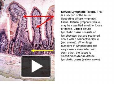 Diffuse Lymphatic Tissue' This is a section of the ileum illustrating ...