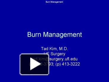 Burn Management presentation | free to view