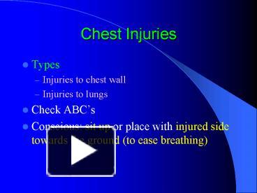 Chest Injuries presentation | free to view