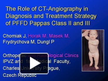 The Role of CTAngiography in Diagnosis and Treatment Strategy of PFFD ...