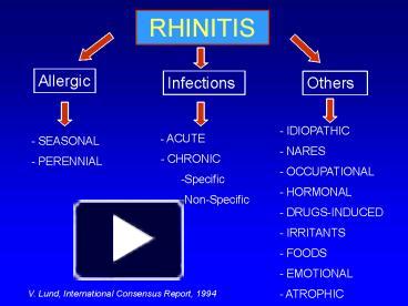 PPT – RHINITIS PowerPoint presentation | free to view - id: ee638-ZDc1Z