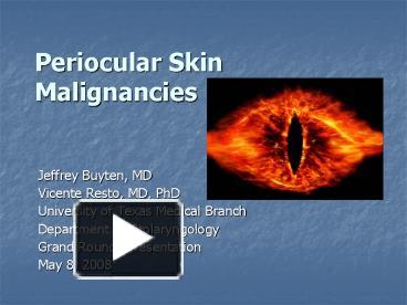 Periocular Skin Malignancies presentation | free to view