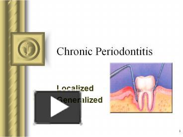 Chronic Periodontitis presentation | free to download