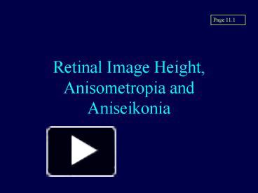 Retinal Image Height, Anisometropia and Aniseikonia presentation | free ...