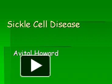 PPT – Sickle Cell Disease PowerPoint presentation | free to view - id ...