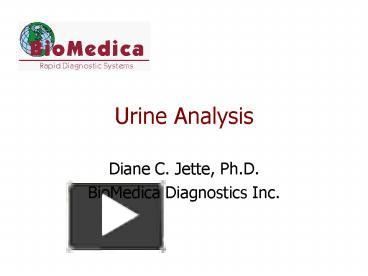 PPT – Urine Analysis PowerPoint presentation | free to view - id: f4082 ...