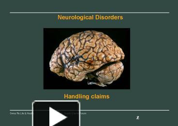 Neurological Disorders presentation | free to view
