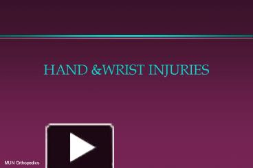 PPT – HAND PowerPoint presentation | free to view - id: f9926-ZDc1Z