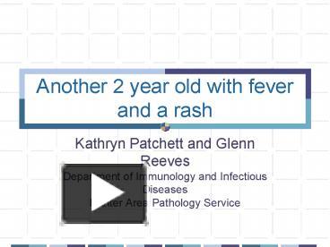 Another 2 year old with fever and a rash presentation | free to view