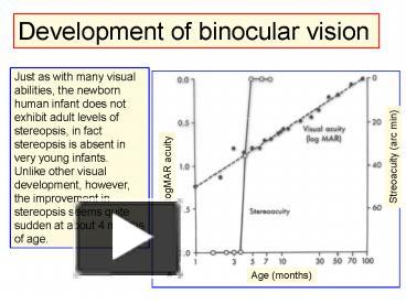 Development of binocular vision presentation | free to view