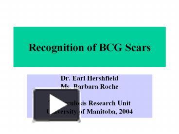 Recognition of BCG Scars presentation | free to download