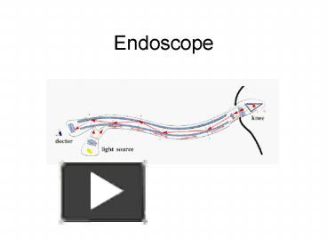 Endoscope presentation | free to view