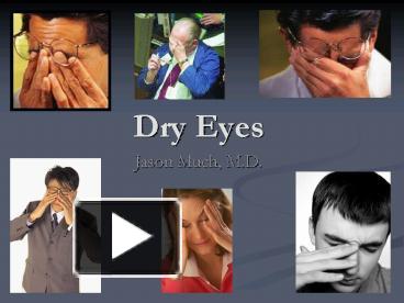 Dry Eyes presentation | free to view
